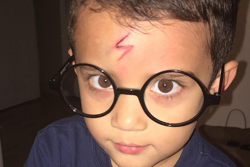Mom Turns Her Four-year Old Son's Scar Into a Very Accurate Harry ...