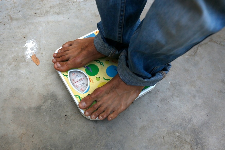 World's Most Obese Man, Weighing 500 Kg, Starts Treatment In Mexico