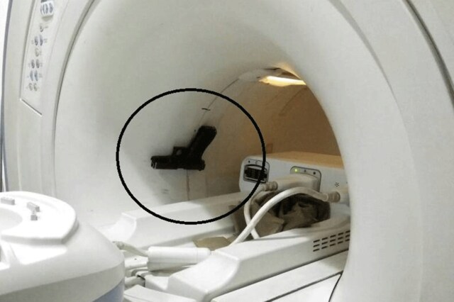 When The Gun Went For an MRI Scan and the Result Thereafter - News18