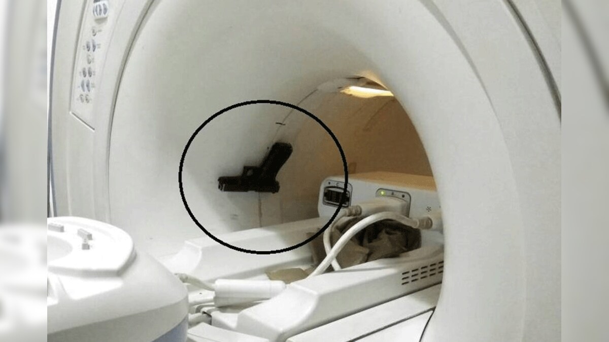 When The Gun Went For an MRI Scan and the Result Thereafter - News18