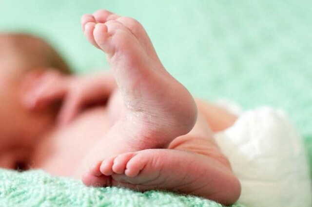 Baby Born With Four Legs at Government Hospital in Kakinada - News18