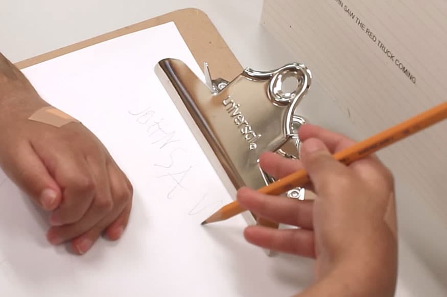 World's First Child Who Underwent Double Hand Transplant Now Able to ...