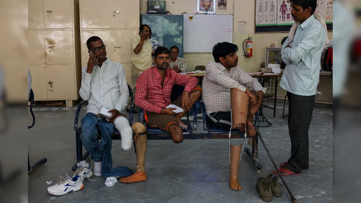 Low-cost Prostheses Offer Indian Amputees a Second Chance - News18