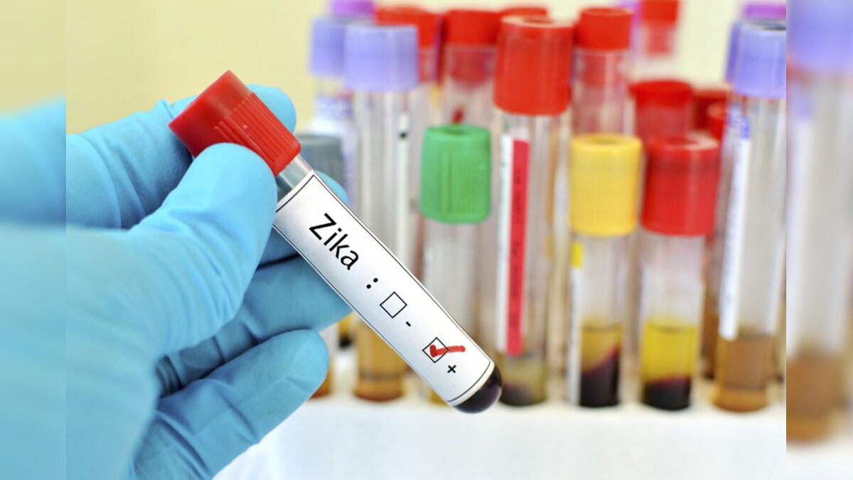 FDA Authorises New Diagnostic Test That Can Detect Signs of Zika ...