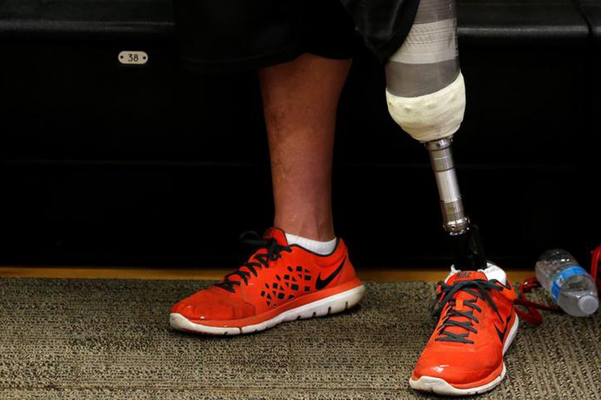 'Amputees Can Learn to Control Robotic Limbs With Minds'