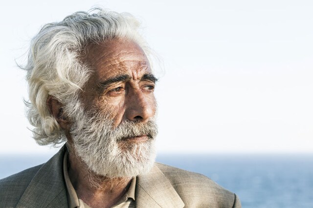 Could Male-pattern Baldness And Premature Graying be Predictors of ...