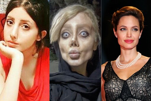 Teen’s Plastic Surgeries To Look Like Angelina Jolie May Have Gone ...