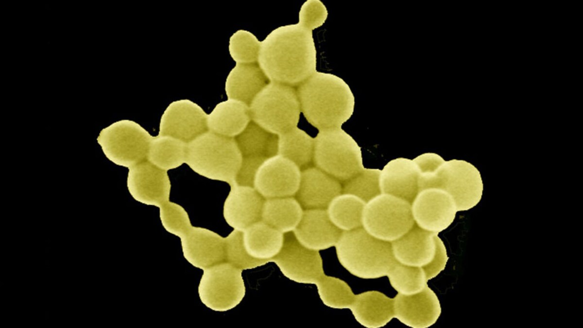 First Gut Bacteria Determines Ability to Fight Chronic Diseases Later ...