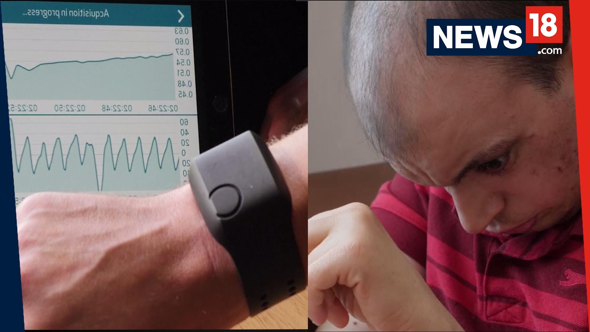 Bio Sensory Watch Can Help Autistic Children - News18
