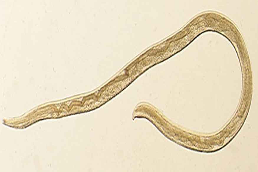 Scientists Discover New Species of Bone-eating Worms During a Study