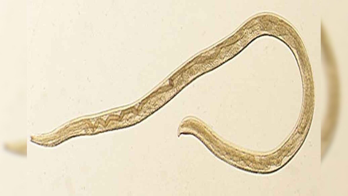 Scientists Discover New Species of Bone-eating Worms During a Study ...