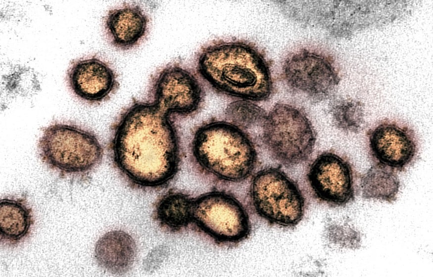 COVID-19 PHOTOS: Up Close with the Deadly Coronavirus - News18