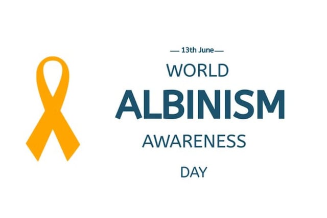 International Albinism Awareness Day 2020: Date, Theme and History - News18