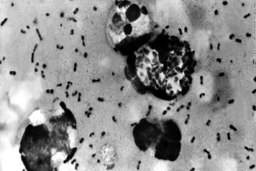Everything to Know About Bubonic Plague As It Spreads Again - News18