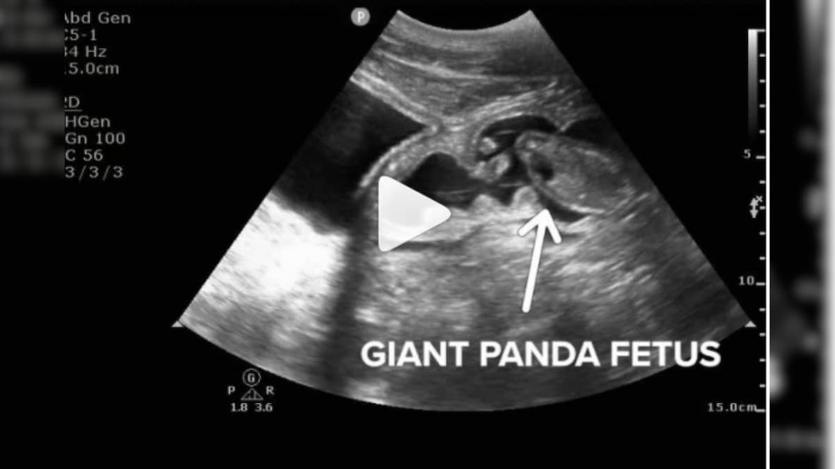 Ever Seen a Giant Panda's Ultrasound? US Zoo Shares it on Internet and ...