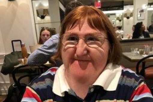 'Not Funny': Disability Activist Slams Parents for Using Her Photo to ...