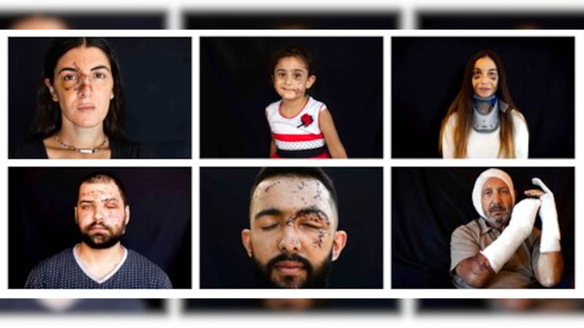 AP PHOTOS: Scars from Beirut blast capture moment of horror - News18