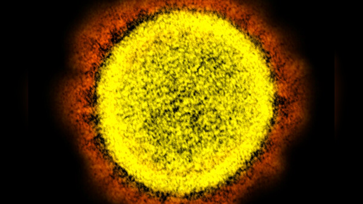 Doctors Studying Why Obesity May Be Tied To Serious COVID-19