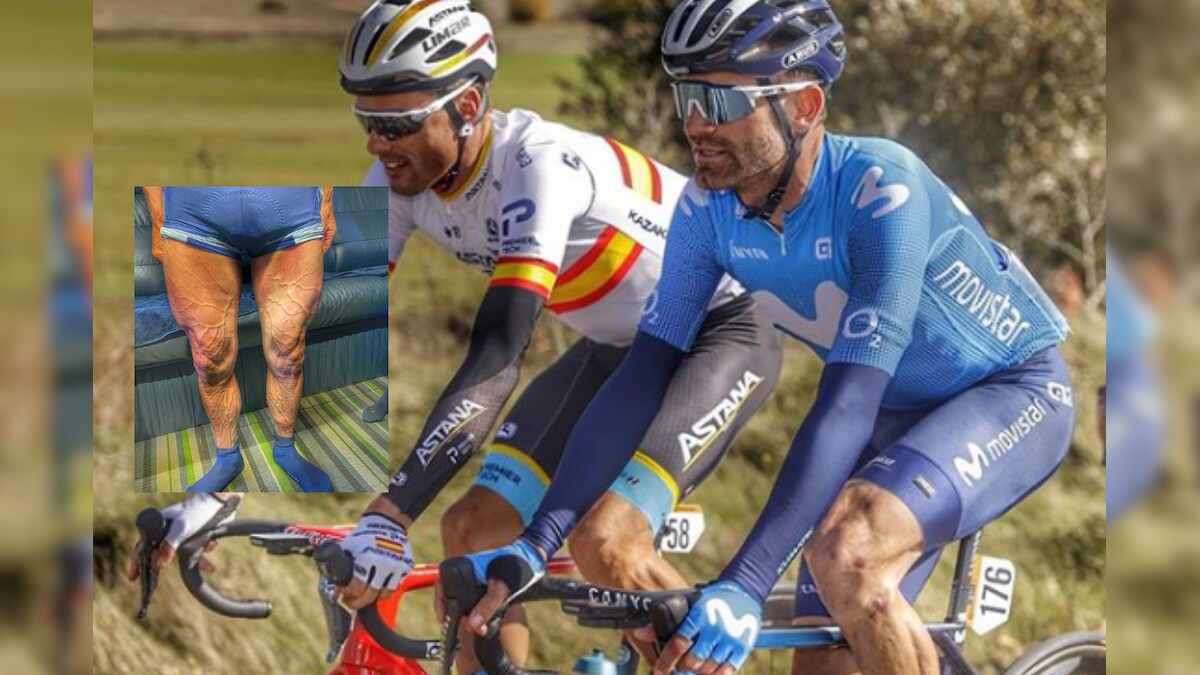 Spanish Racer Shares Picture of His Legs After 4 Hours of Cycling and ...