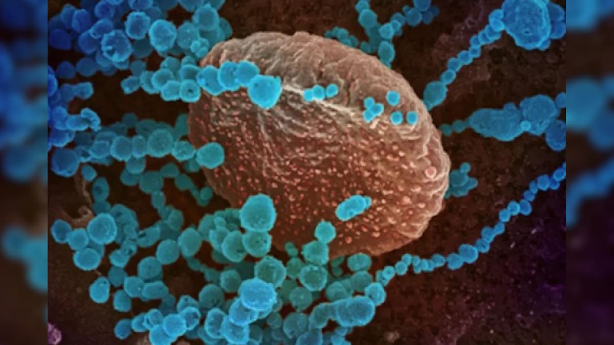 Chapare Virus: All You Need to Know About the Rare Ebola-like Virus ...