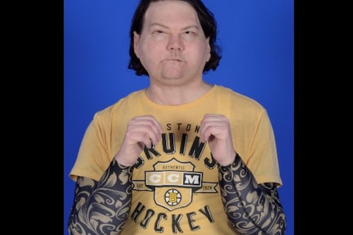 US Accident Victim Gets New Lease of Life With World's First Double ...