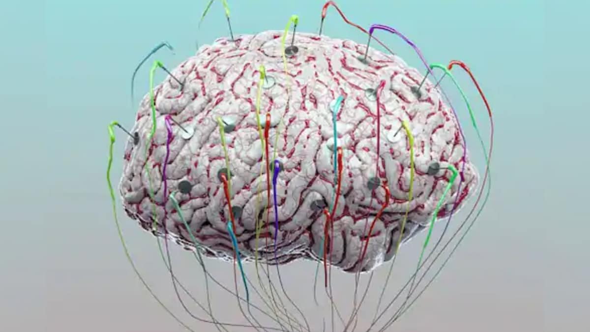 Scientists Figured Out Why Humans Have Big Brains – AWBR