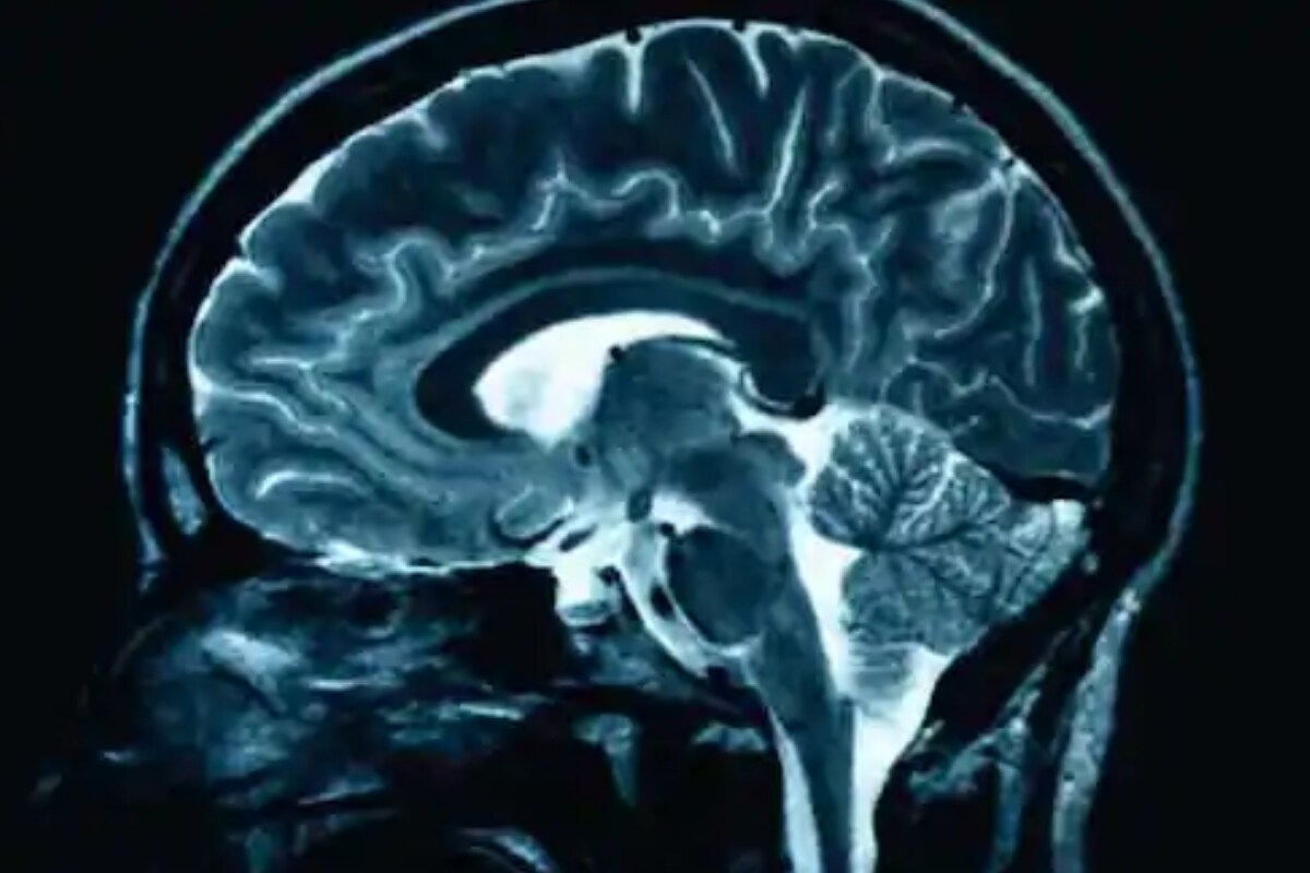 Modern Human Brain Originated 1.7 Million Years Ago in Africa, New ...