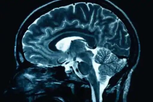 Modern Human Brain Originated 1.7 Million Years Ago in Africa, New ...