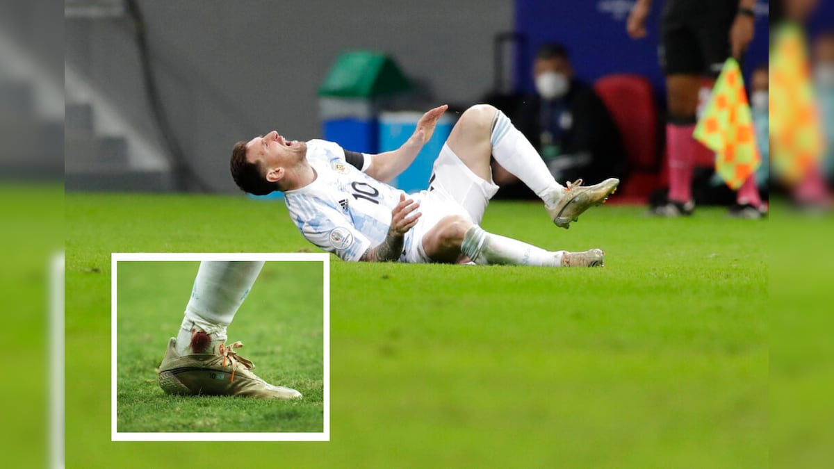Lionel Messi Plays with a Bleeding Ankle during Argentina's Copa ...