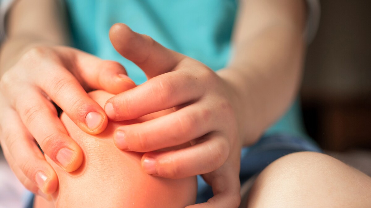 World Arthritis Day 2021: Did You Know That This Disease Also Impacts ...