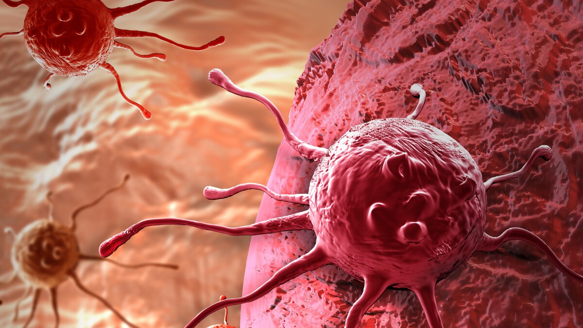 Chemotherapy, Radiation May Not Be Needed to Kill Cancer Cells, Finds ...