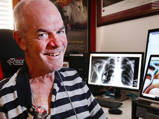 Paralysed Man Tweets Using Brain Implant that Converts Thoughts into ...