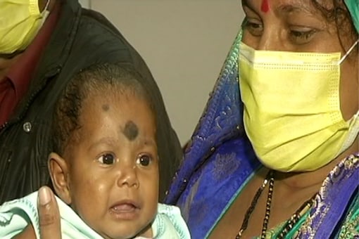 Odisha Newborn's 'True Human Tail' Surgically Removed in World's First ...