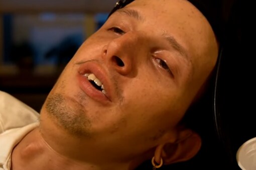 29-Year-old US Man's Rare Medical Condition is Turning His Muscles into ...
