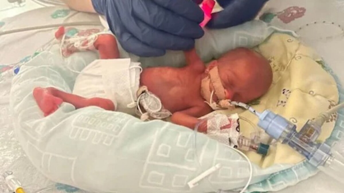 17-year-old's Newborn UK's Smallest Baby to Survive in Last 2 Decades ...