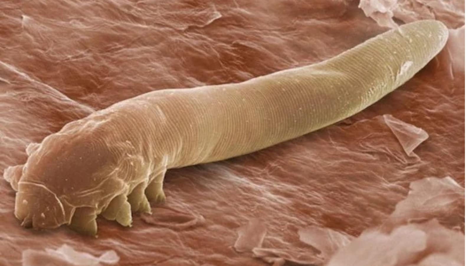 These Microscopic Mites Live, Breed On Our Faces, and We Didn't Even ...