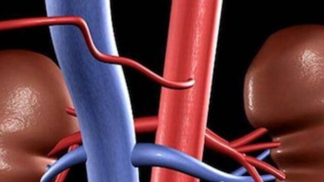 Kanpur Man Has 3 Kidneys, Doctors Say It's Rare But Nothing to Worry ...
