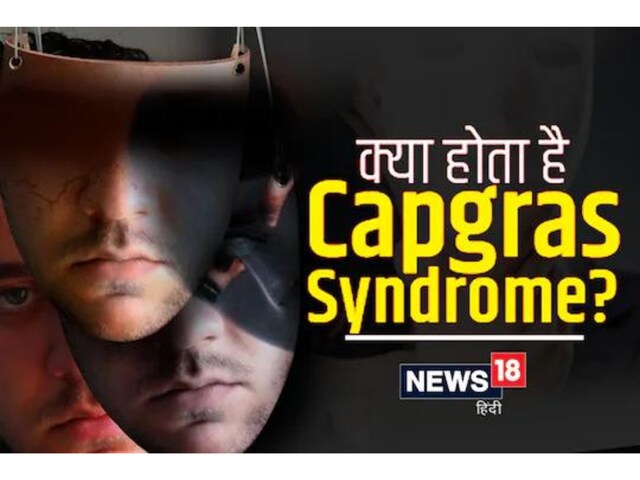 What is Capgras Syndrome? Causes, Symptoms and Treatment - News18