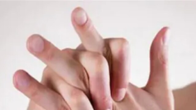 This Doctor Explains the Science Behind Cracking Knuckles, Debunks ...