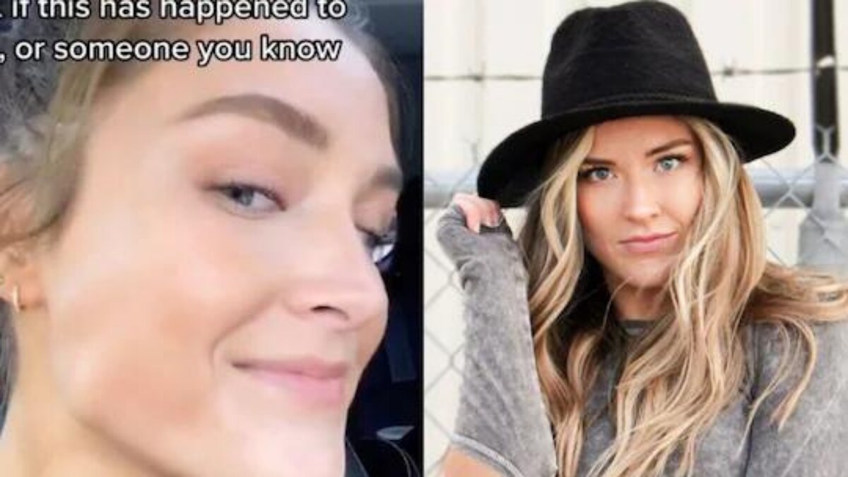 This Woman Underwent Botox Surgery. The Result will Blow Your Mind - News18