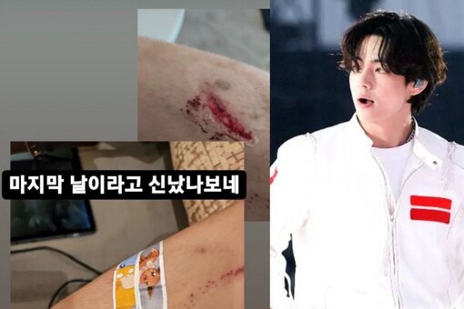 BTS: Kim Taehyung Gets Bruises On Last Day Of PTD Las Vegas Concert ...