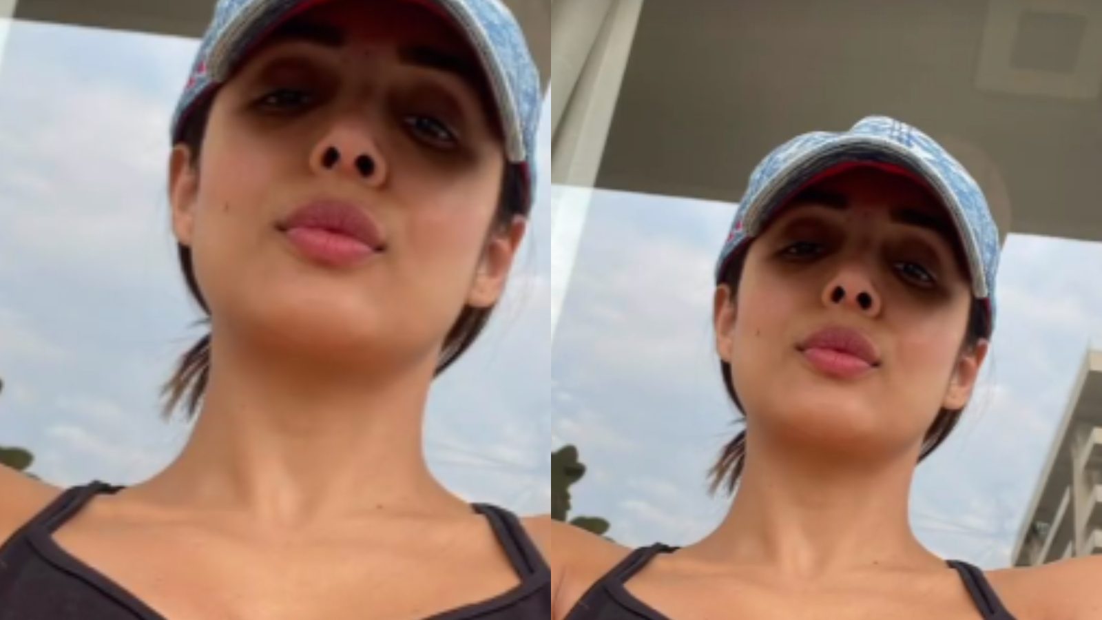Malaika Arora Shares 1st Pic Since Accident, Treats Fans With Stunning ...