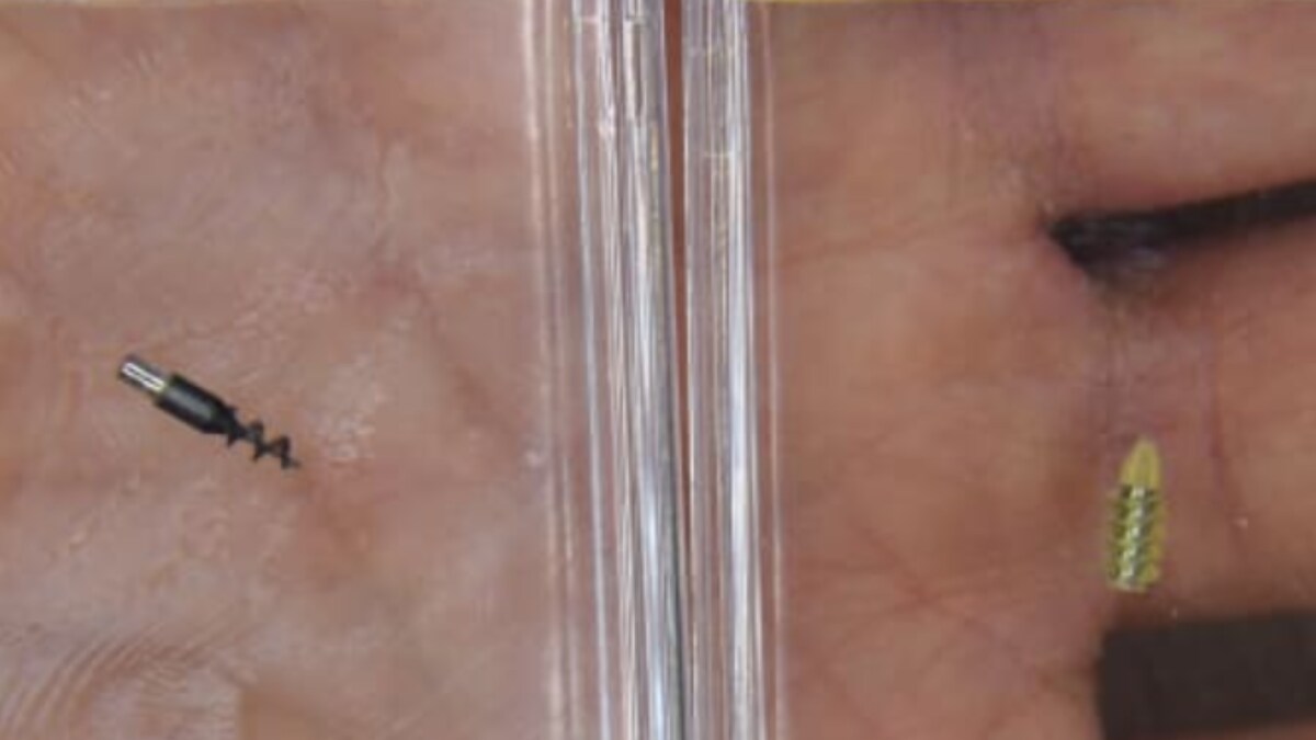 These Tiny Robots Could Travel Inside Human Skull and Treat Brain ...