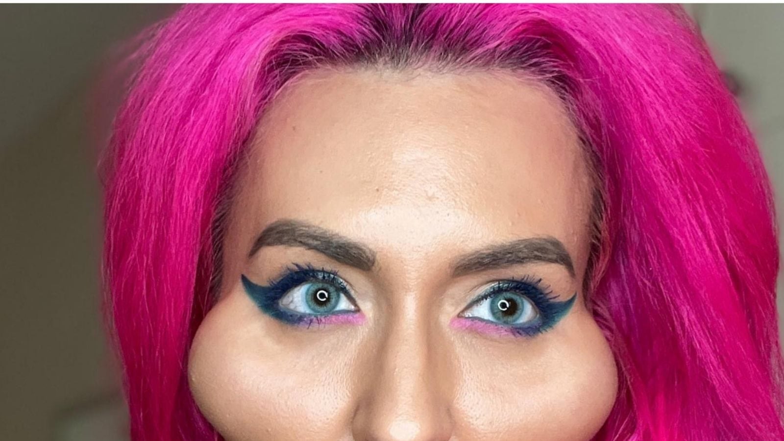 Ukrainian Model With ‘World’s Biggest Cheeks’ Wants More Surgeries on ...