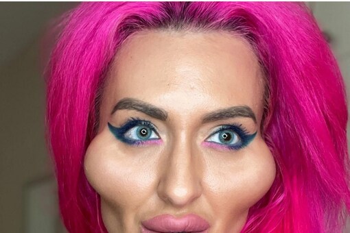 Ukrainian Model With ‘World’s Biggest Cheeks’ Wants More Surgeries on ...