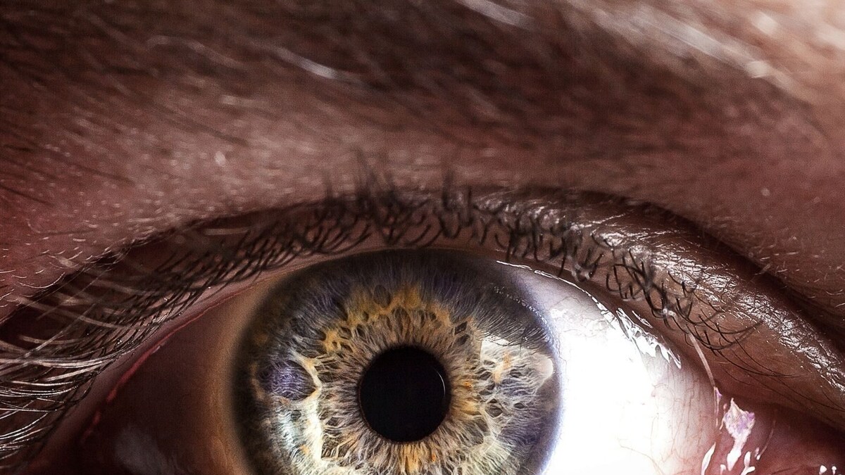 Wriggling Larvae Found in France Man's Cornea after a Fly Laid Eggs in ...