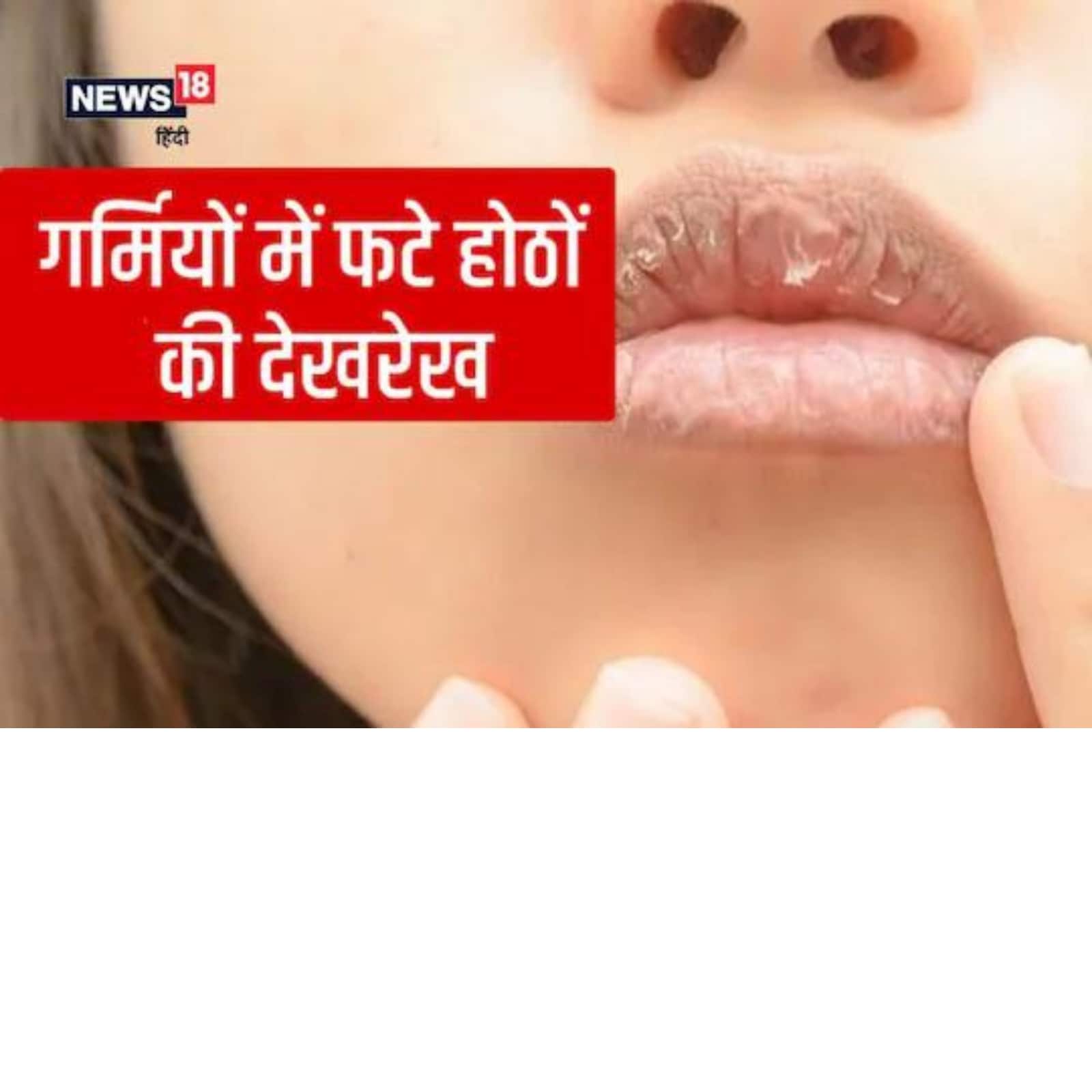 Chapped Lips In Summer Treatment | Lipstutorial.org