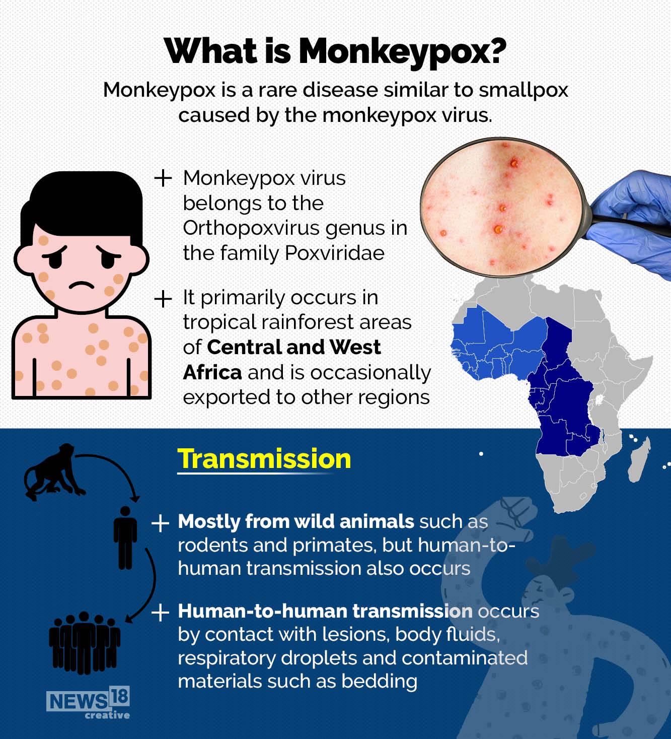 As Monkeypox Detected in North America, Europe; Here's All You Need to ...