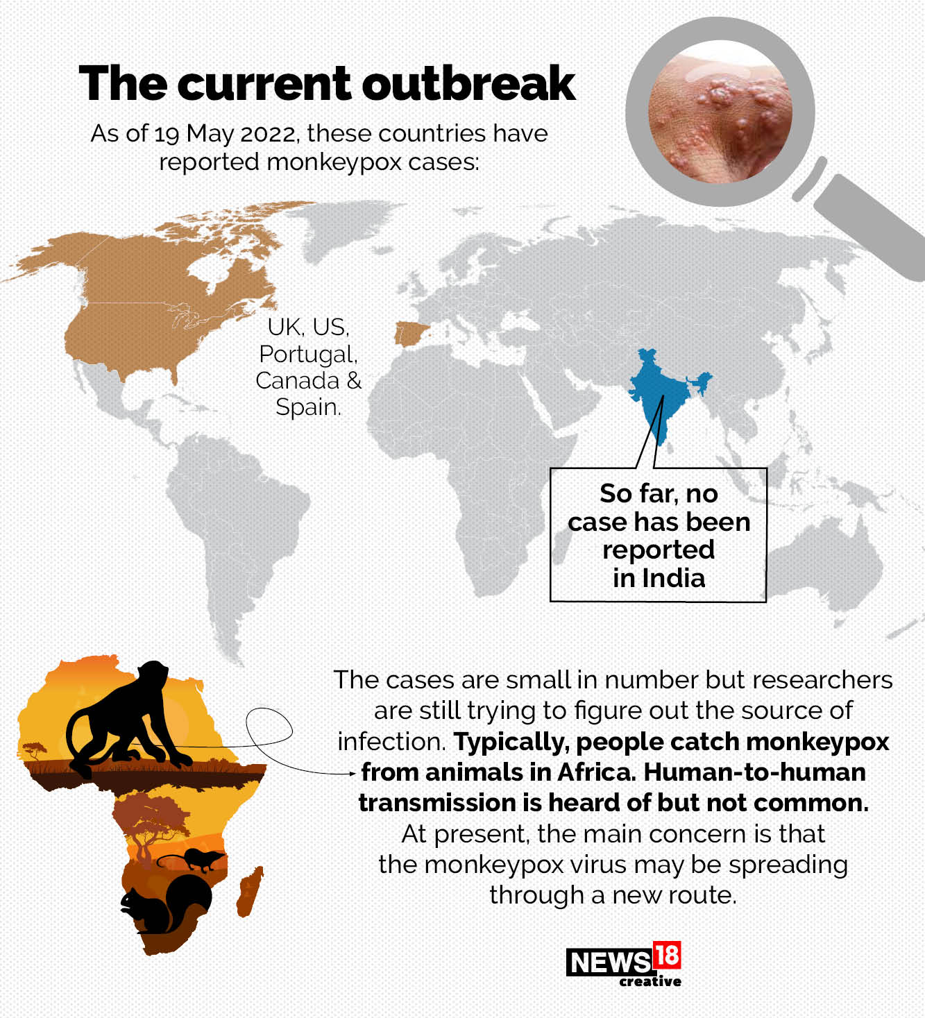 As Monkeypox Detected in North America, Europe; Here's All You Need to ...