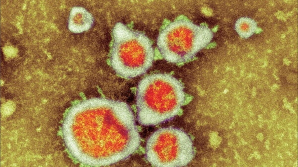 This Common Virus With Cold-Like Symptoms Led to Over 1L Deaths in Kids ...
